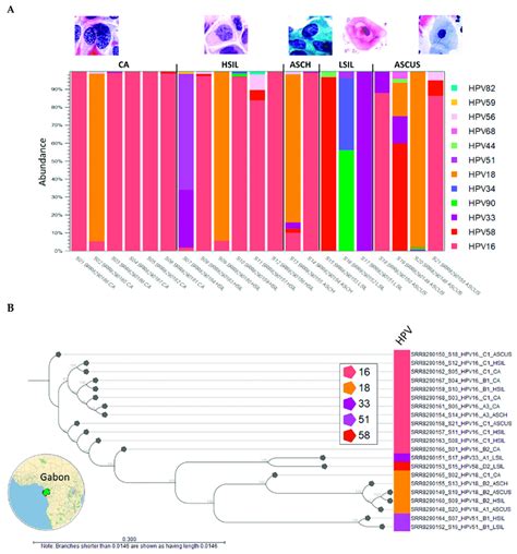 Viral Hybrid Capture Vhc Analysis A Relative Abundance Of Hpv