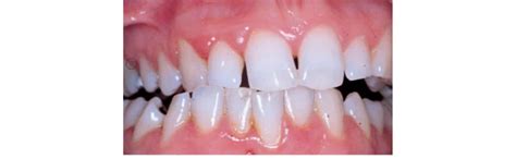 𝐎𝐜𝐜𝐥𝐮𝐬𝐚𝐥 𝐭𝐫𝐚𝐮𝐦𝐚 🦷 𝐅𝐨𝐫𝐞𝐬𝐭 And 𝐑𝐚𝐲 😊 𝐃𝐞𝐧𝐭𝐢𝐬𝐭𝐬 𝐎𝐫𝐭𝐡𝐨𝐝𝐨𝐧𝐭𝐢𝐬𝐭𝐬 𝐈𝐦𝐩𝐥𝐚𝐧𝐭