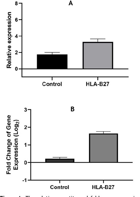 Figure 1 From Association Of Hla B27 Gene And Rheumatoid Arthritis