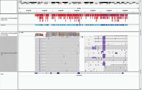 Igv Plot Showing That Hla‐drb1 Is Homozygous Represented By The Vcf Download Scientific