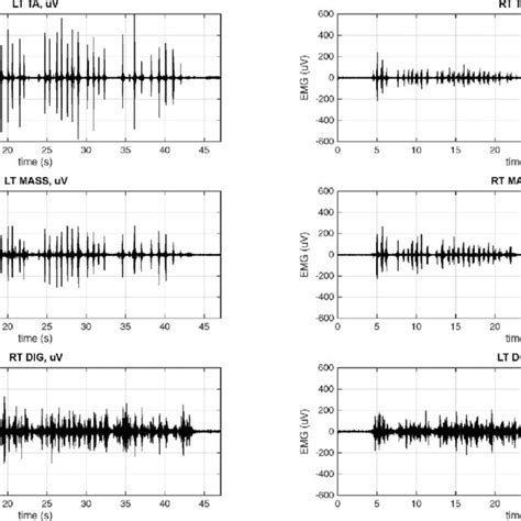 signal onset detection and segmentation step a threshold defines the