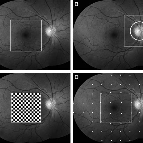 Pdf Relationship Between Pattern Electroretinogram Frequency Domain