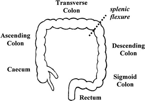 Sigmoid Flexure Bull