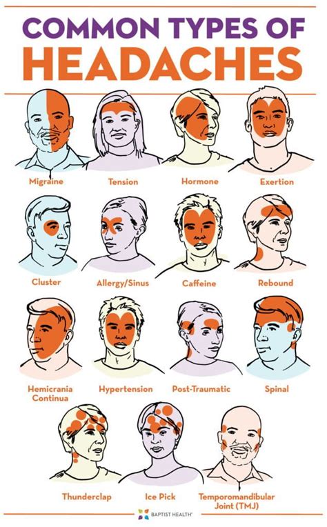 Common Types Of Headaches Baptist Health Headache Types Headache Sinusitis
