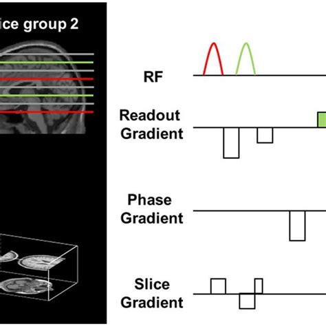 time domain snr tsnr and average signal leakage sl varied as the