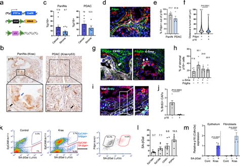 胰腺腺癌中衰老的癌症相关成纤维细胞限制 Cd8 T 细胞激活并限制小鼠对免疫治疗的反应 Nature Communications X Mol