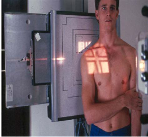 X Ray Positions Lab 1 Flashcards Quizlet