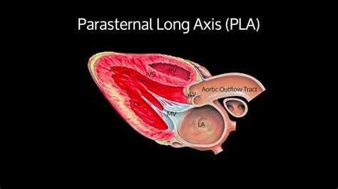 Basic Transthoracic Echocardiography Cardiac Ultrasound Tte Made Simple Youtube
