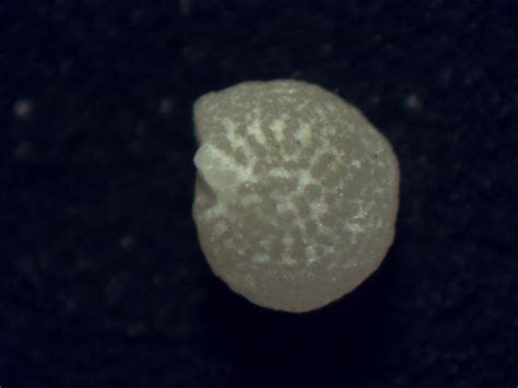 This Is A Fossil Of Benthic Foraminifera Enlarged X45 Can You Identify The Species Or