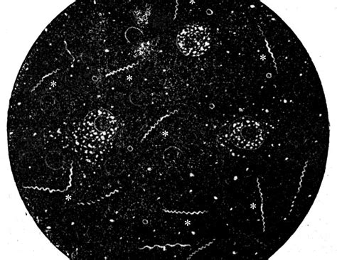 Dark Field Microscopy And Cfslyme Cfs Remission