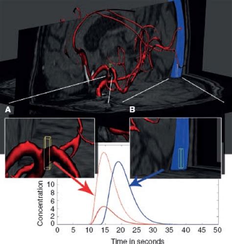 Arterial Input Function And Venous Output Function Ento Key