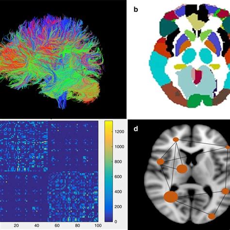 Brain Network Analysis A Whole Brain Tractography Created From The Fa Download Scientific