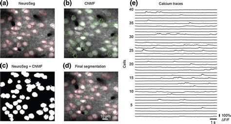 a combined approach in which morphology based detection neuroseg is
