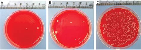 Growth Of Enterococcus Faecalis After 72 Hours Of Disinfection With