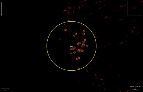 cell detection with stardist on 2d stack images usage and issues