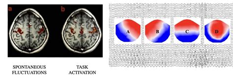 Autobiographical Memory And Neuroimaging