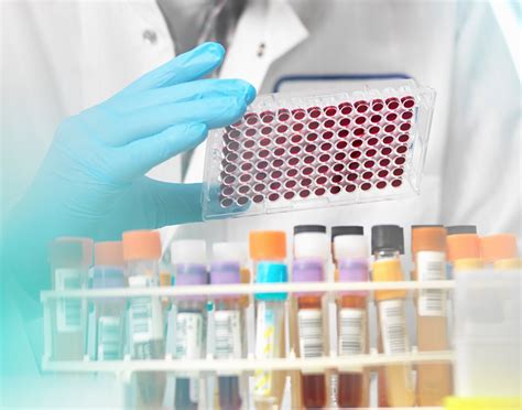 Mononucleosis Spot Test