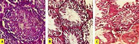Selenium Supplementation In The Form Of Selenium Nanoparticles And