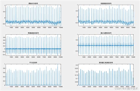 【项目实战 Matlab】：pan Tompkins检测算法 Csdn博客