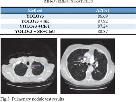 Figure 2 From Pulmonary Nodule Detection Algorithm Based On Yolov3