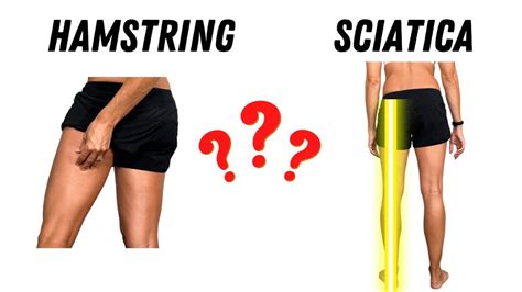 Hamstring Tightness Vs Sciatica YouTube