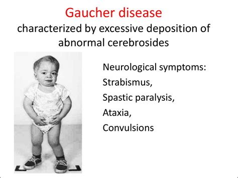 Gauchers Disease In Infants At David Killian Blog
