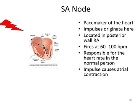 Ppt Disorders Of Cardiac Function Powerpoint Presentation Free