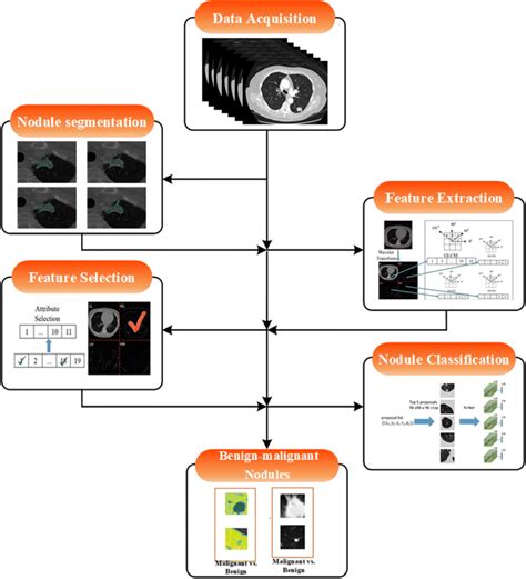 The Basic Stages Of A Popular Cadx System Download Scientific Diagram
