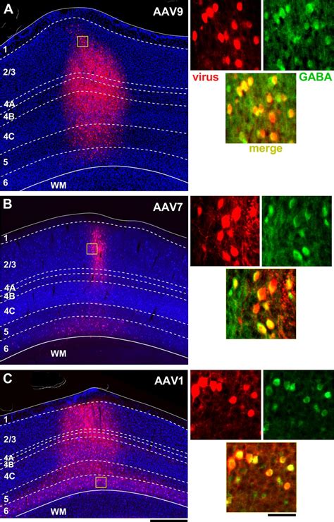 Laminar Specificity And Coverage Of Viral Mediated Gene Expression Restricted To Gabaergic