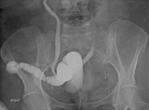 Loopogram Buyxraysonline