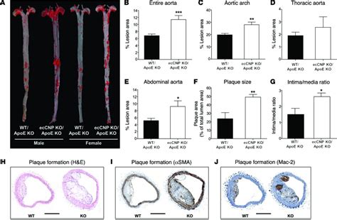 Endothelial C Type Natriuretic Peptide Maintains Vascular Homeostasis PMC