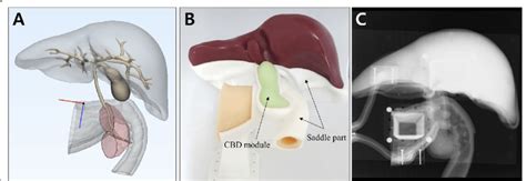 3d Modeling And Fabrication Of Ercp Training Simulator A 3d Model