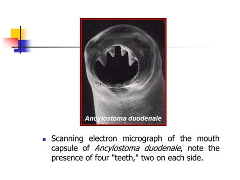 Parasitology Hookworm Pptx Slides 1 Ppt