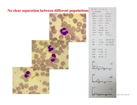 Wbc Histogram Pdf