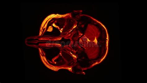 Mri Brain Scan Magnetic Resonance Image Ct Scan Of Human Brain In Dynamic Stock Footage