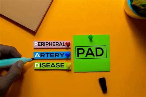 Are You At Risk Of Developing Peripheral Artery Disease Pad Advanced Vascular Solutions