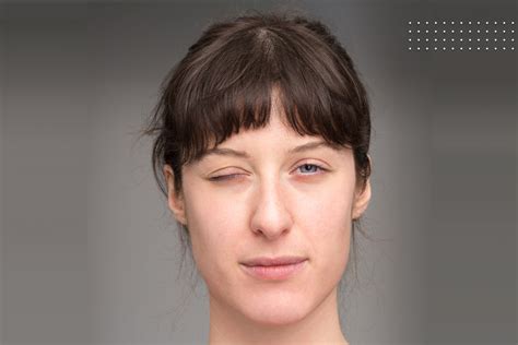 Diagnosis And Treatment Of Hemifacial Spasm