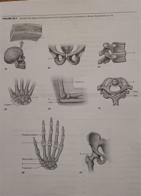 Solved Figure 19 7 Identify The Types Of Structural And