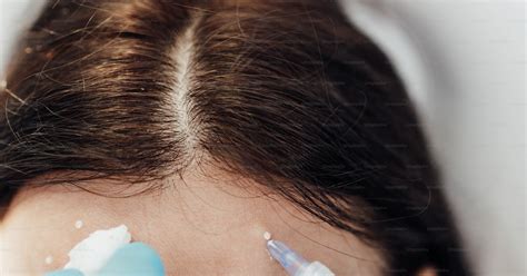 매력적인 금발 여성이 미용 클리닉에서 젊어지게하는 얼굴 주사를 맞고 있습니다 전문 미용사가 보툴리눔으로 여성 주름을 채우고 있습니다 사진 Unsplash의 페이셜