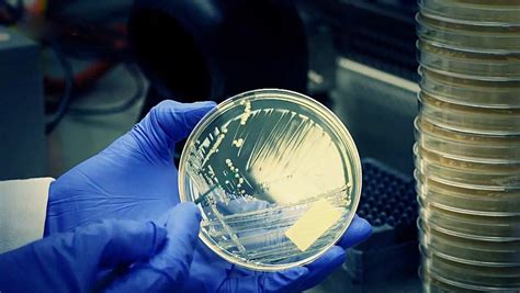 Use Of A Robotic Pipeline For Bacterial Genetics At University College
