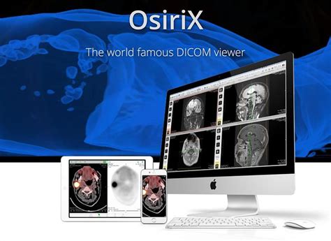 New Osirix Pacs And Dicom Viewer For Sale At Integrity Medical Sy