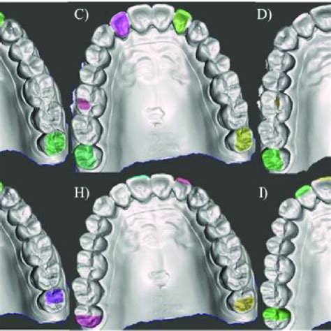 Schematic Representation Of The Artificial Defects Colors Randomly Download Scientific Diagram