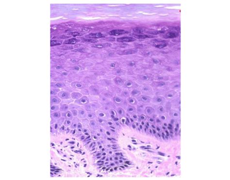 Anatomy Epidermis Quiz