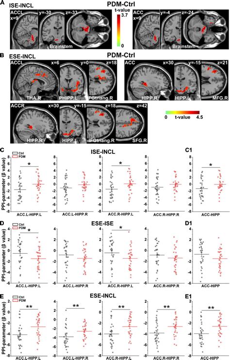 Pelvic Pain Alters Functional Connectivity Between Anterior Cingulate Cortex And Hippocampus In