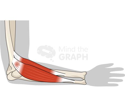 Free Tendonitis Arm Body Icons Symbols Pictures And Images Mind The Graph