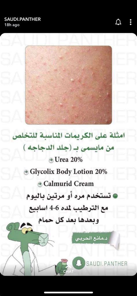 التخلص من جلد الوزة Skin Care Mask Beauty Skin Care Routine Body