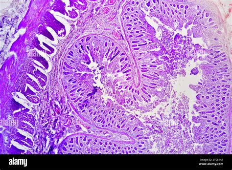 Small Intestine Cross Section Showing Mucosa Submucosa Lamina Propria