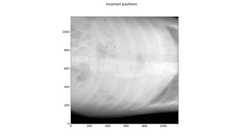 Unexpected Drr Orientation · Issue 99 · Arcadelab Deepdrr · Github