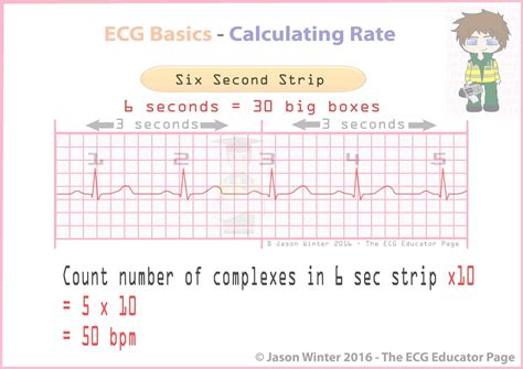 EKG Basics Rate Calculation Medbabe EKG Basics HeartRate Rate Intervals EKGBasics