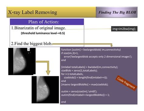 microcalcification identification in digital mammogram for early